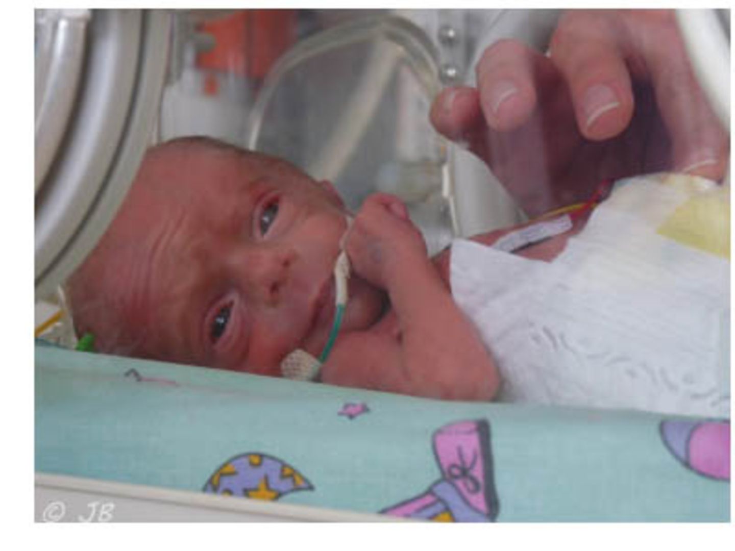 Fabelhafte 6 Wochen Altes Baby Bildernull
