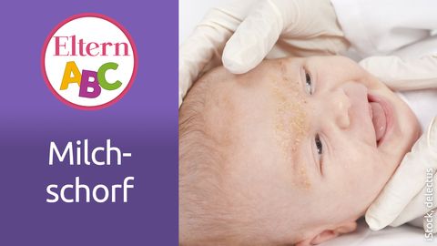 Milchschorf oder Kopfgneis? Das ist der Unterschied | Eltern.de