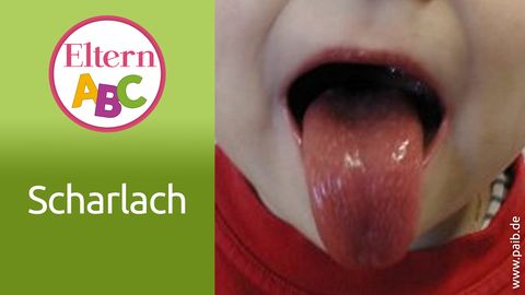 Eltern ABC: Scharlach | Eltern.de
