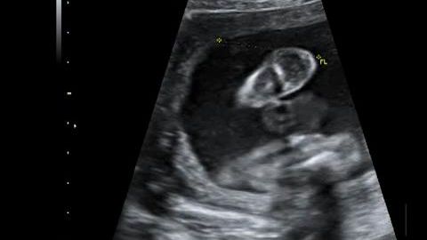 SSW 20: Alle Infos zur 20. Schwangerschaftswoche | Eltern.de