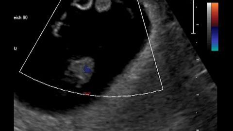 7. Schwangerschaftswoche (7. SSW): Alle Infos | Eltern.de