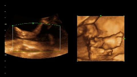 SSW 39: Alle Infos zur 39. Schwangerschaftswoche | Eltern.de