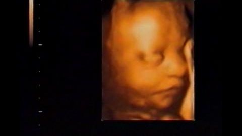 SSW 27: Alle Infos zur 27. Schwangerschaftswoche | Eltern.de